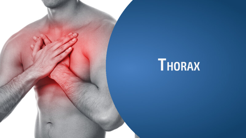 Iode et scanner à visée vasculaire - FNMR